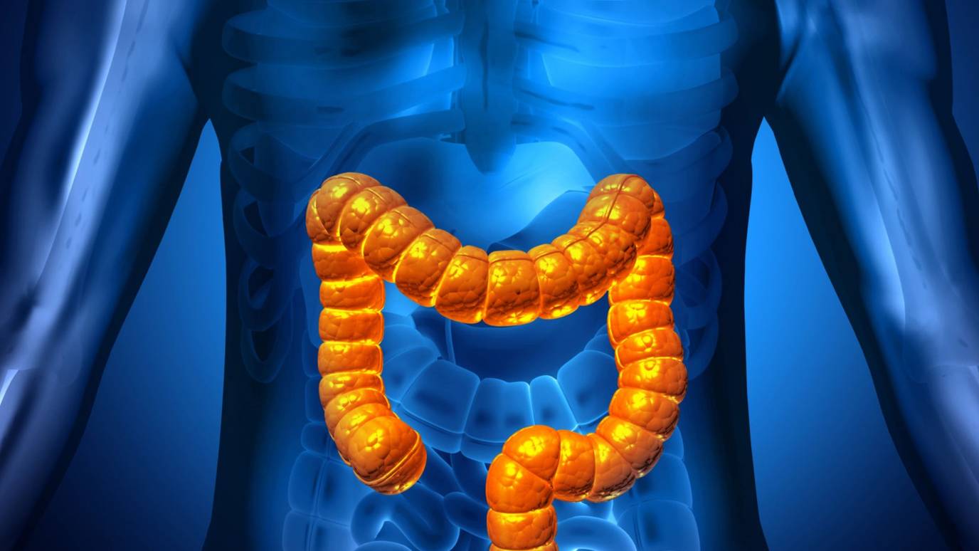 ACS Study Finds Early-Onset Colorectal Cancer Cases Surge Globally ...