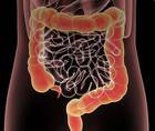 Fellows - Crohn's Colitis Professional