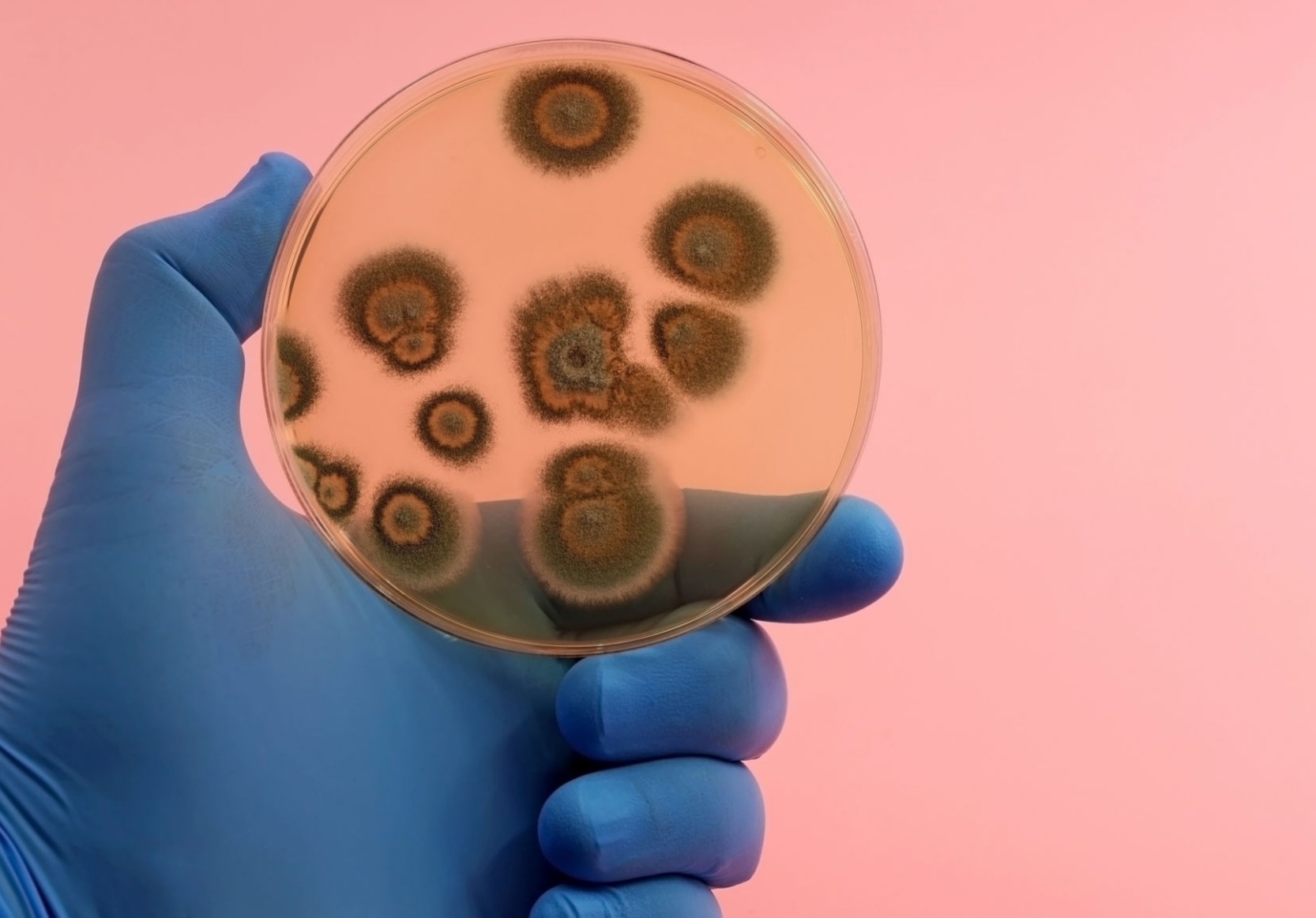 New Estimate Doubles Likely Deaths from Fungal Disease Globally ...