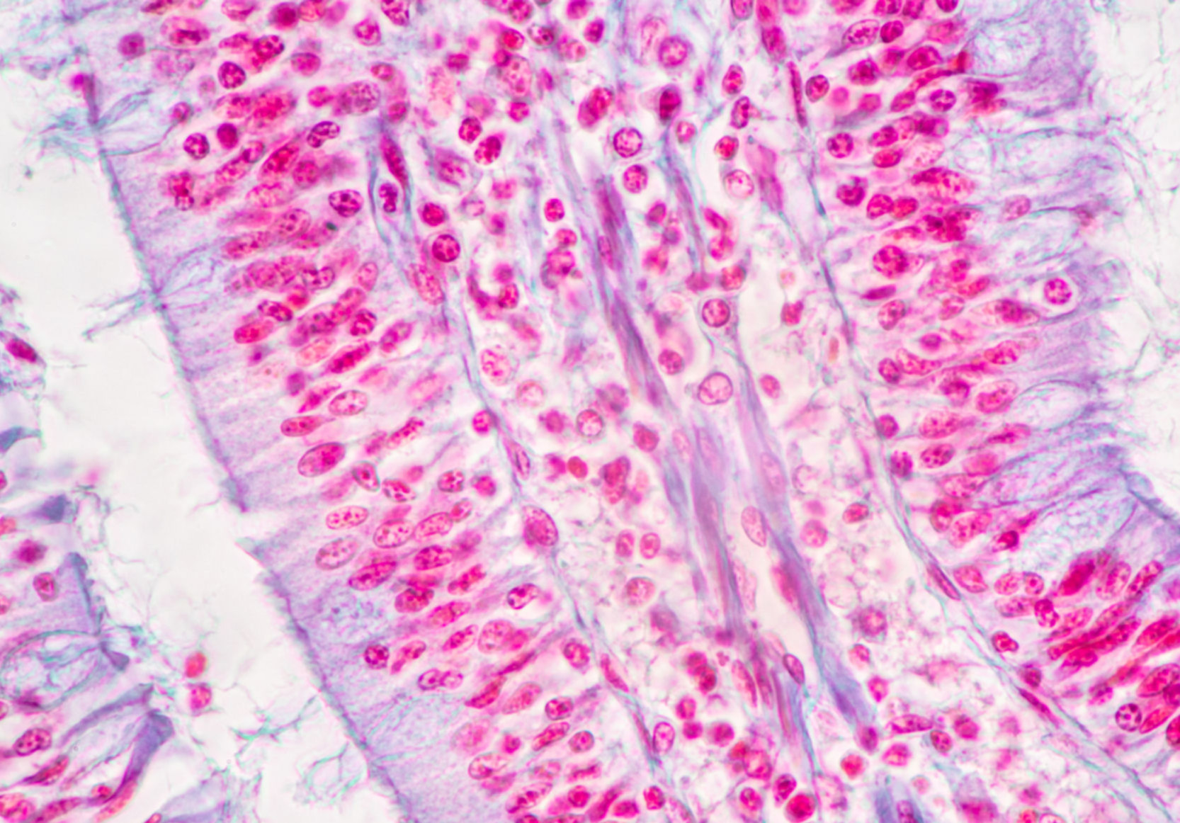 Gene Analysis Generates Spatial Map of Intestinal Cells and Traces ...