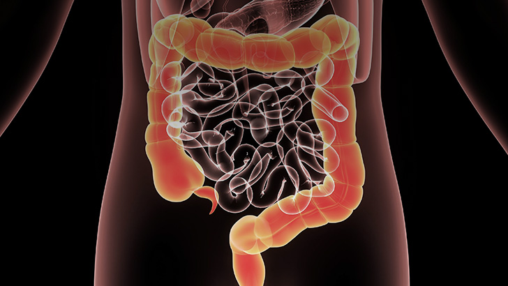Fellow Foundations Lecture 3: Management of Ulcerative Colitis in ...